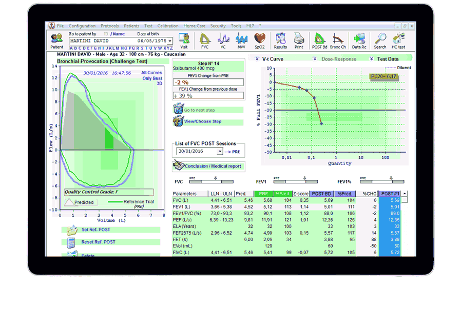 Spiromètre Spirobank II BASIC MIR